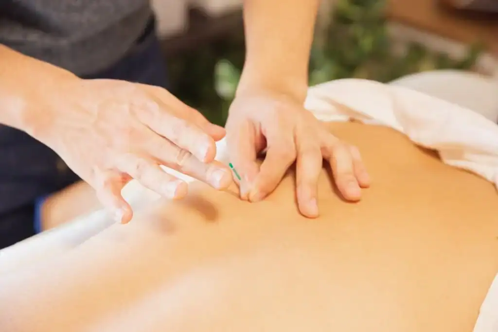 Acupuncture Cost in Ontario (2025)